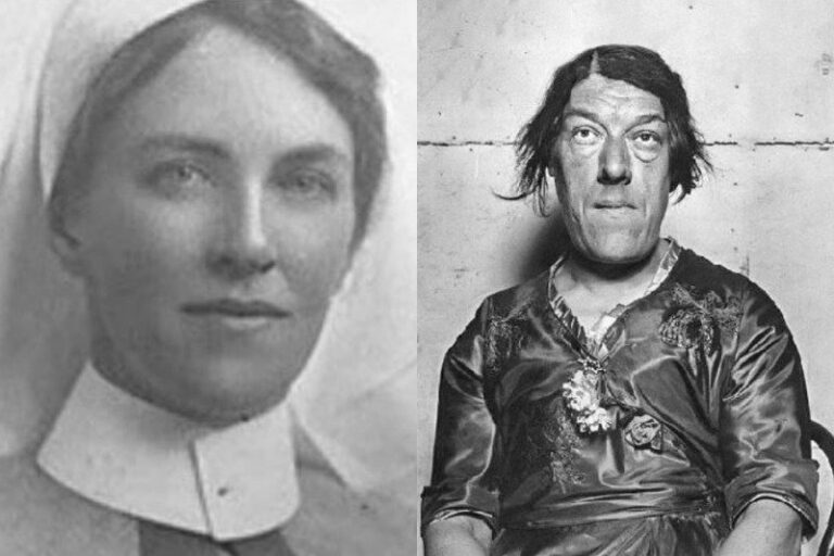 Mary Ann Bevan: Il destino drammatico della “donna più brutta del mondo”